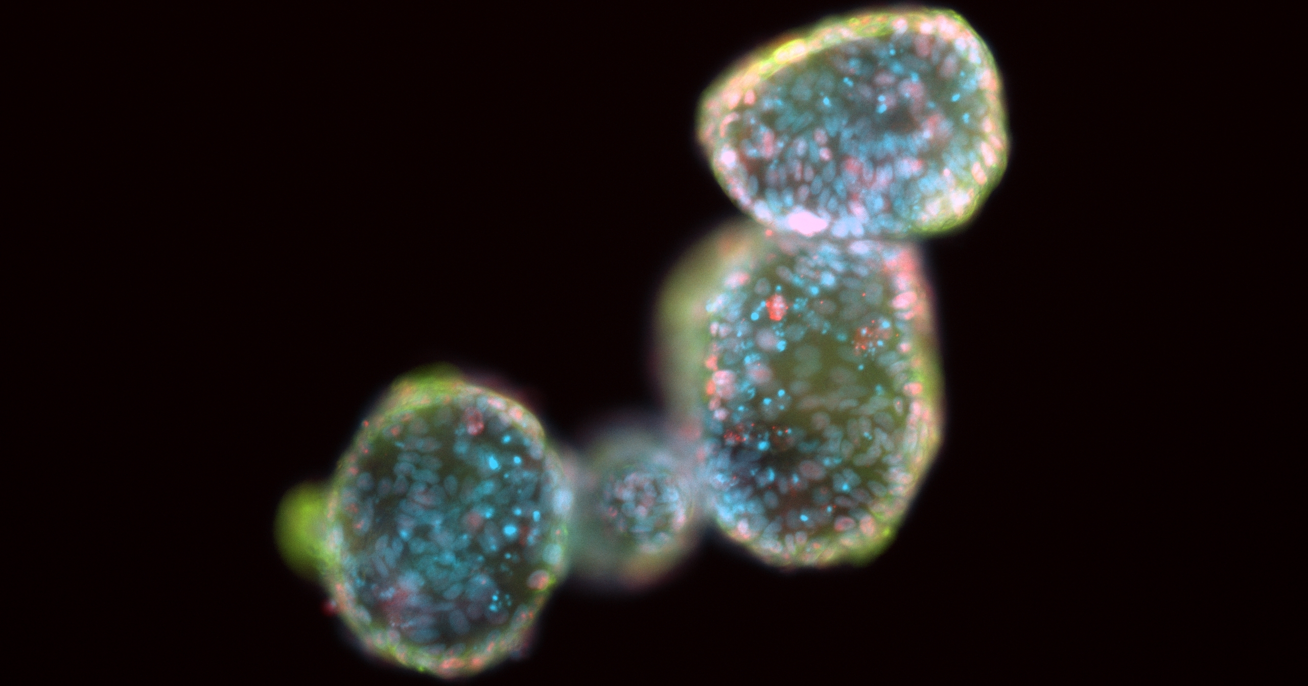 Organoid Growth Media: Techniques to Help You Streamline Culture